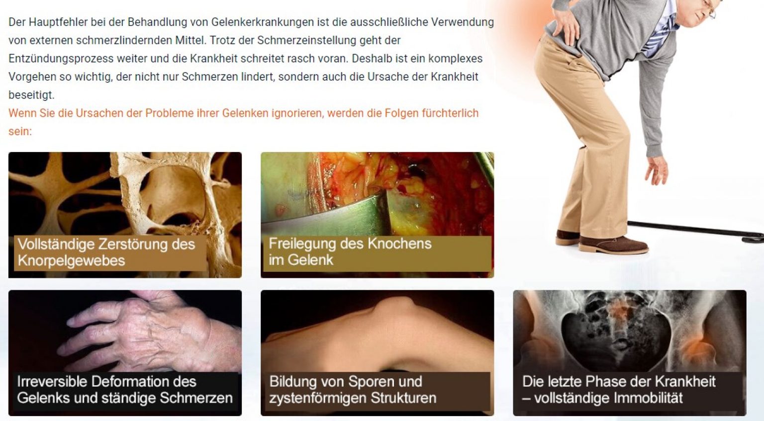 Artoflex ᐉ Wirkung, Anwendung, Erfahrungen, Nebenwirkungen, Bewertung ...