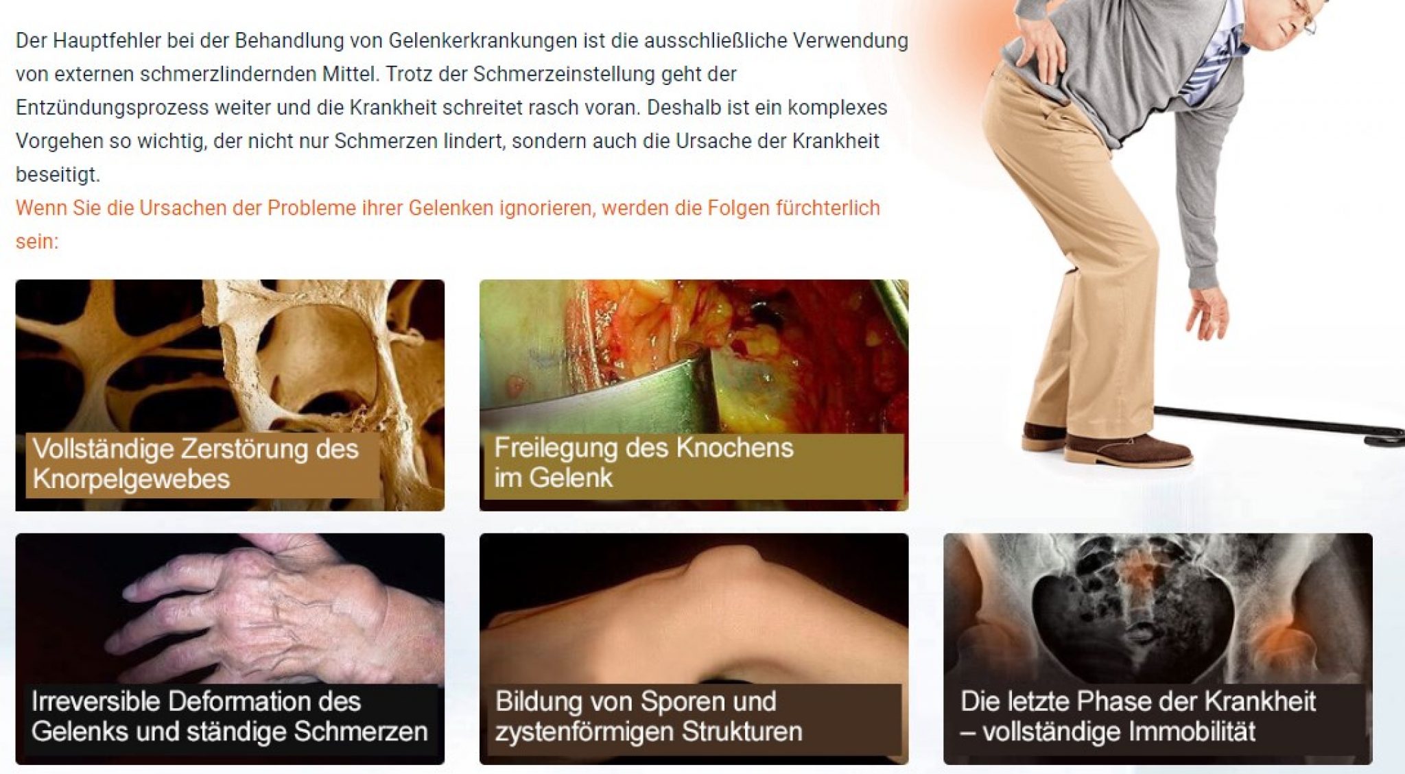 Artoflex ᐉ Wirkung, Anwendung, Erfahrungen, Nebenwirkungen, Bewertung ...