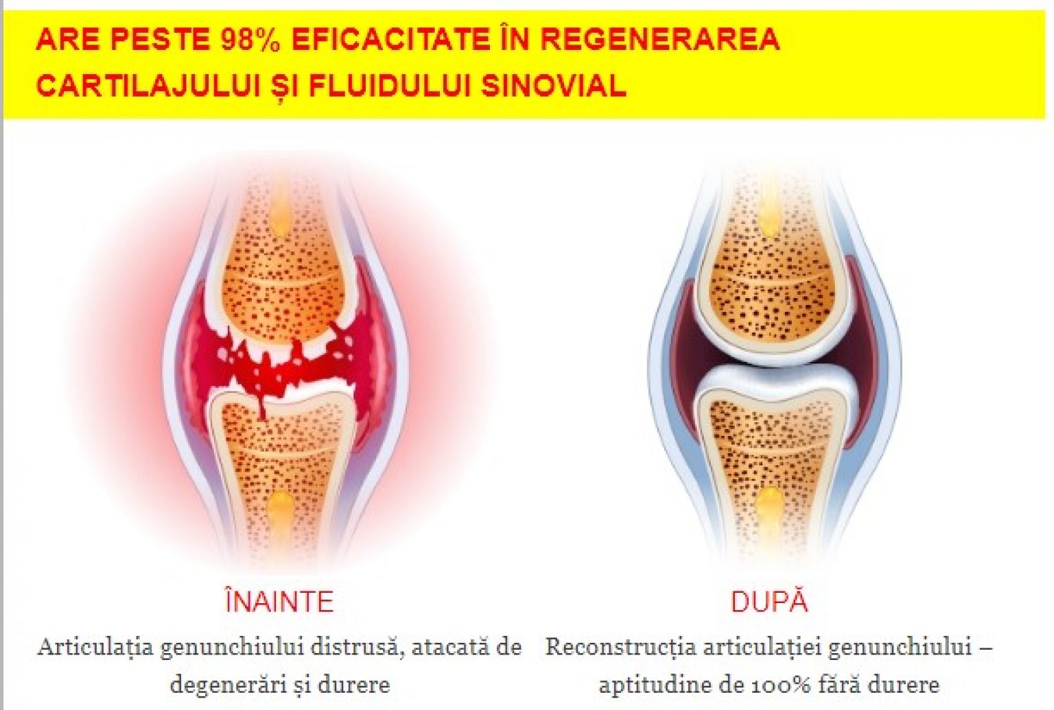 ᐉ Knee Active Plus Wirkung, Anwendung, Erfahrungen, Nebenwirkungen ...