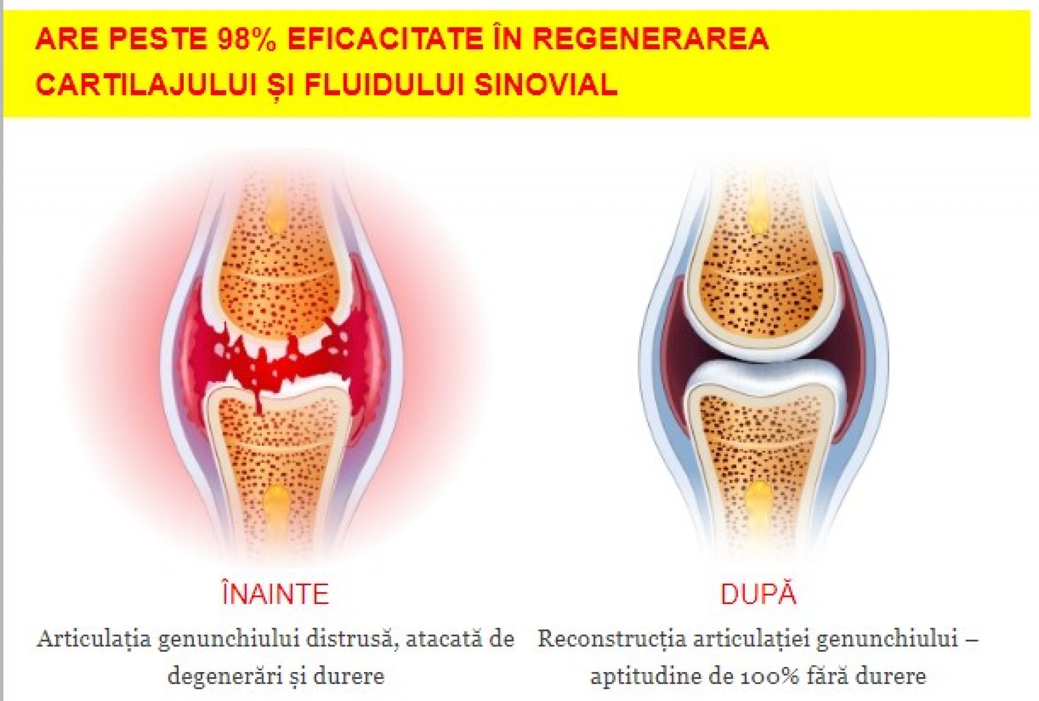 ᐉ Knee Active Plus Wirkung, Anwendung, Erfahrungen, Nebenwirkungen ...